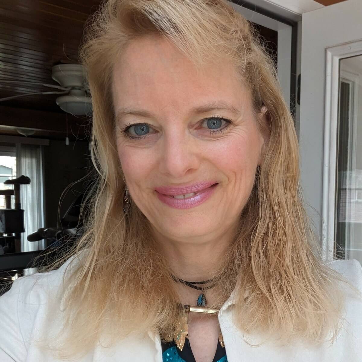 Joint Pain & Sjögren's, Julie's Story | Sjögren’s Foundation